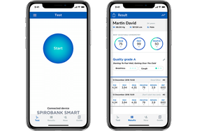 PC-Based and Hand-held Spirometers, Oximeters & EKG Catalogue - MIR